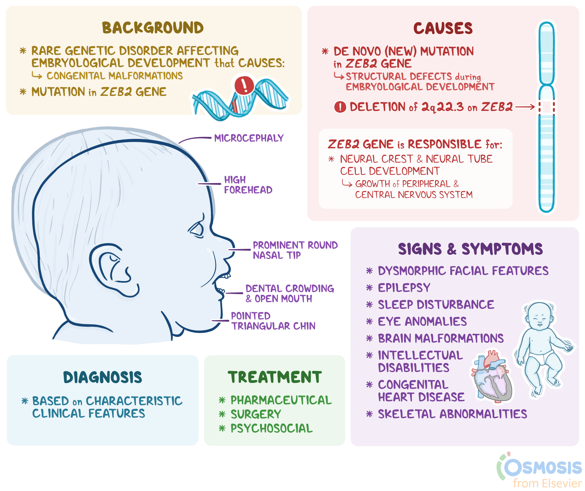 Mowat-Wilson Syndrome: What It Is, Causes, Signs and Symptoms | Osmosis