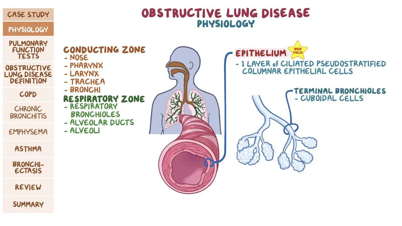 Obstructive lung diseases: Pathology review: Video, Causes, & Meaning ...
