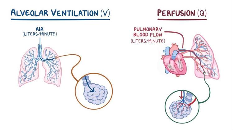 Ventilation-perfusion ratios and V/Q mismatch: Video, Causes, & Meaning ...