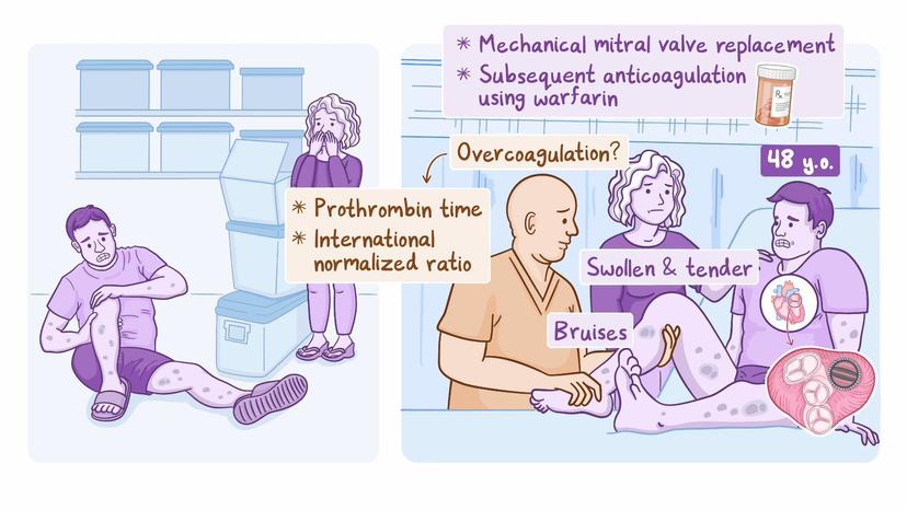 Coagulation studies - Prothrombin time (PT) and international ...
