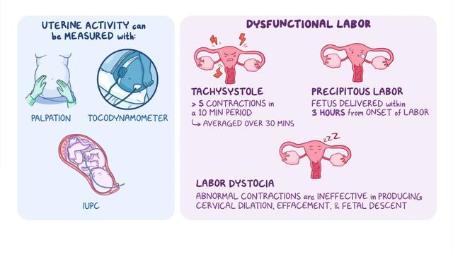 Fetal Assessment During Labor: Vídeo & Anatomía | Osmosis