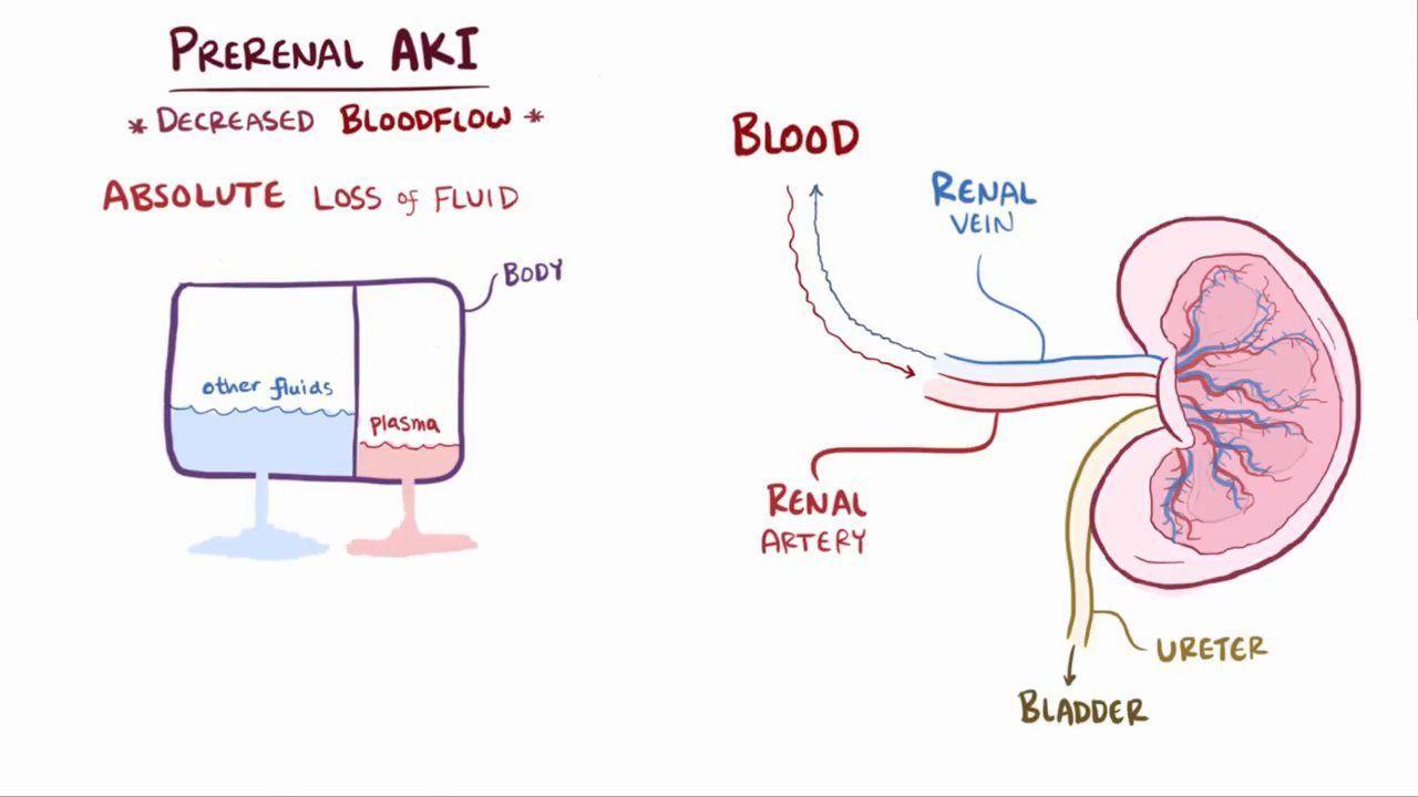 azoemia-prerrenal-v-deo-anatom-a-definici-n-osmosis