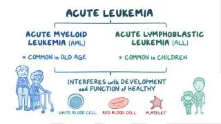 Leukemias Notes: Diagrams & Download PDF | Osmosis