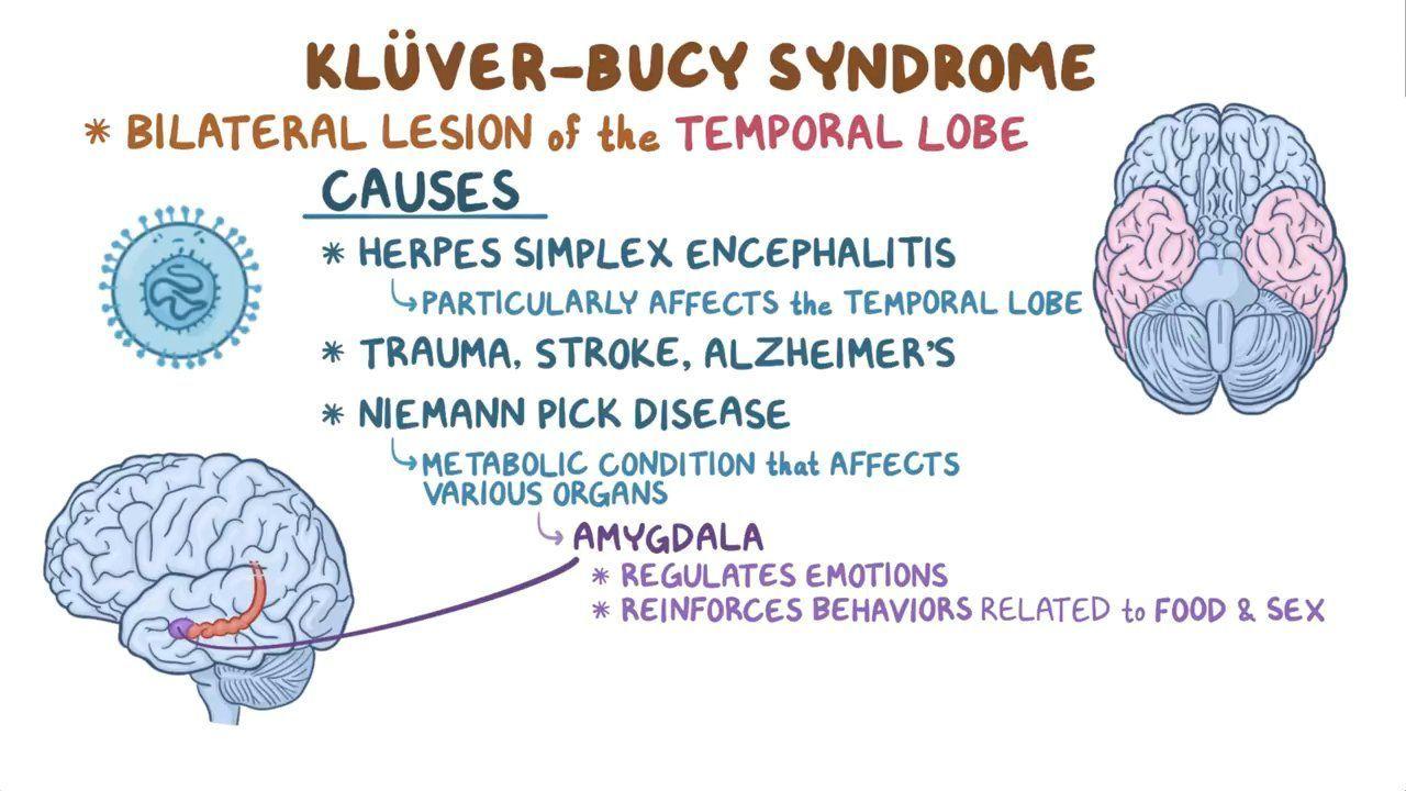 Kluver-Bucy syndrome: Video, Causes, & Meaning | Osmosis