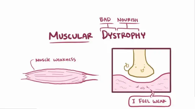 Video: Osteomalacia and rickets | Osmosis
