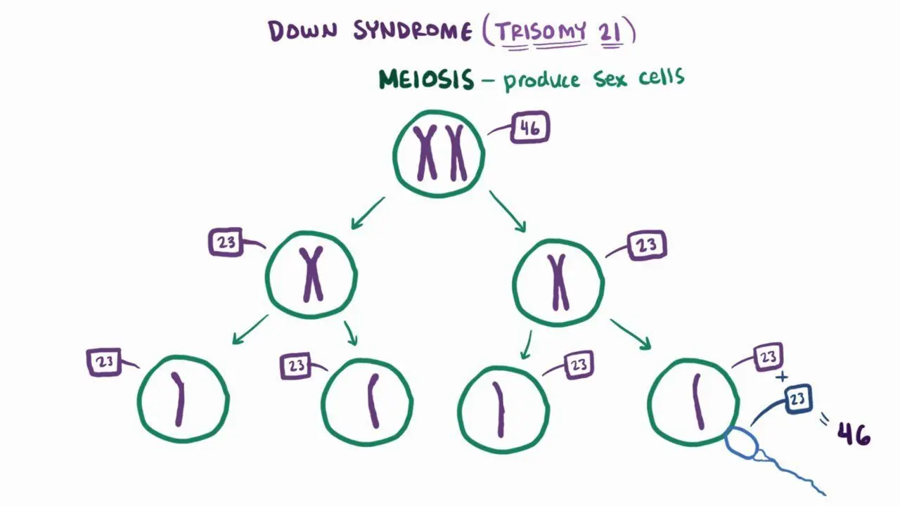 Down syndrome (Trisomy 21): Video, Causes, & Meaning | Osmosis