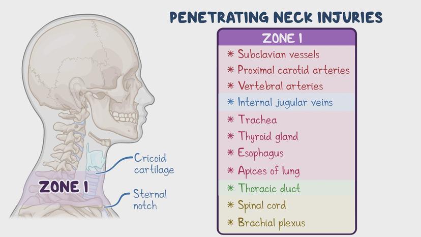 Approach to penetrating neck injury: Video & Meaning | Osmosis
