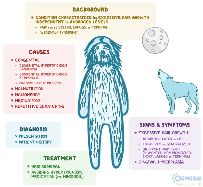 Hypertrichosis: What Is It, Causes, Signs and Symptoms, and More | Osmosis