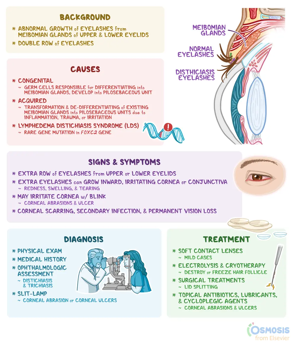 Distichiasis: What It Is, Causes, Diagnosis, and More | Osmosis