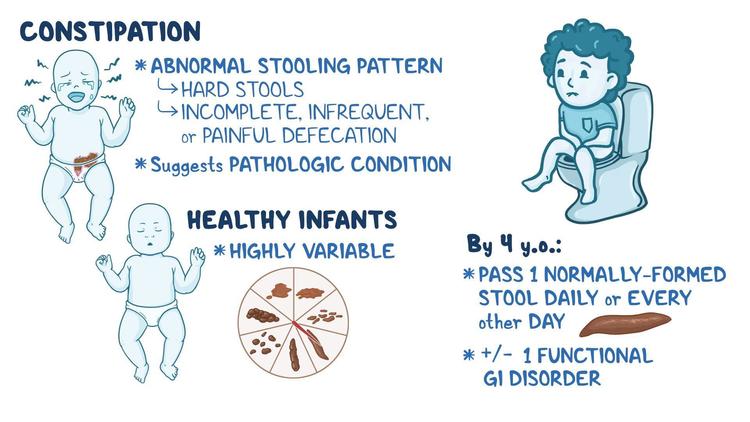 Approach to constipation (pediatrics): Video & Meaning | Osmosis