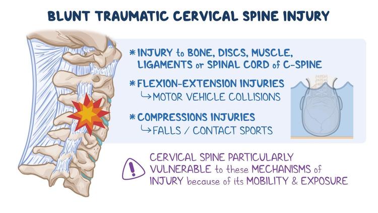 Approach to blunt traumatic cervical spine injuries: Clinical sciences ...