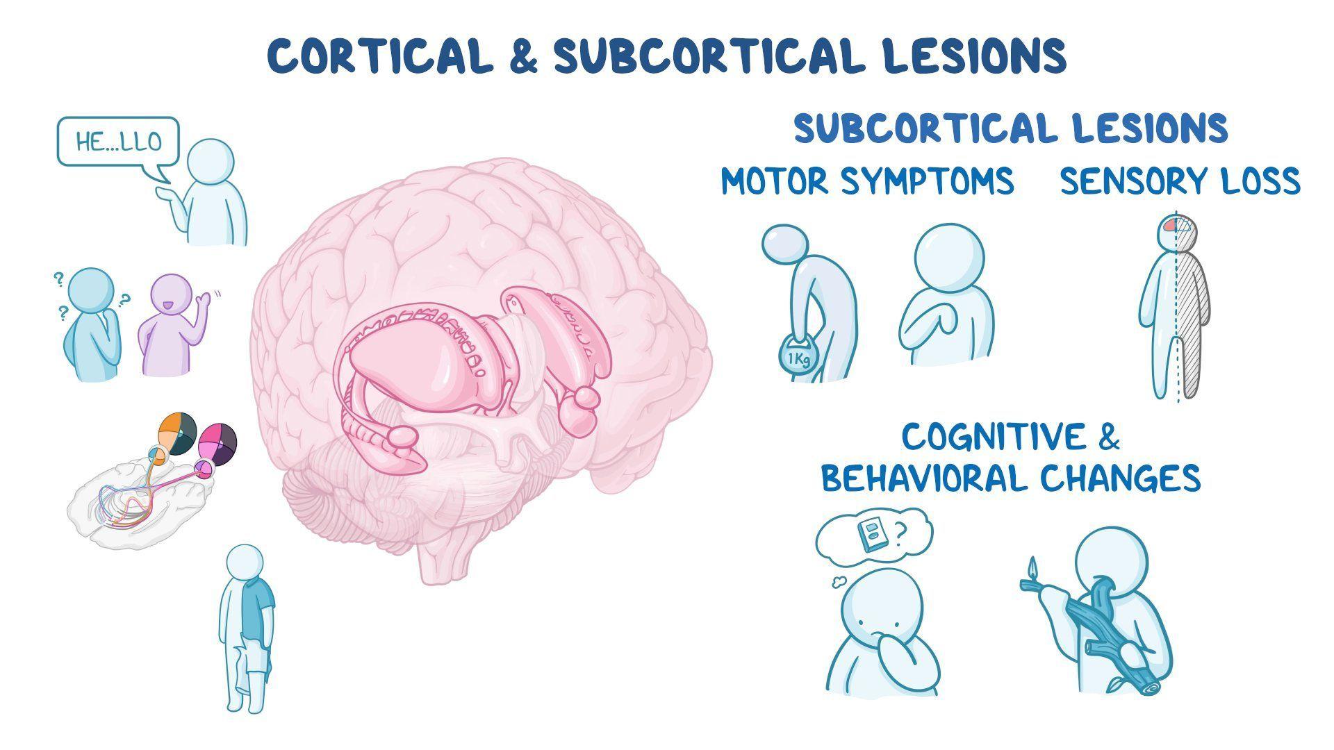 Approach to differentiating lesions (cerebral cortical and subcortical ...