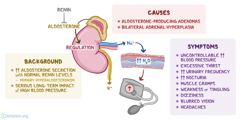 Conn Syndrome: What Is It, Causes, Symptoms, Diagnosis, Treatment | Osmosis