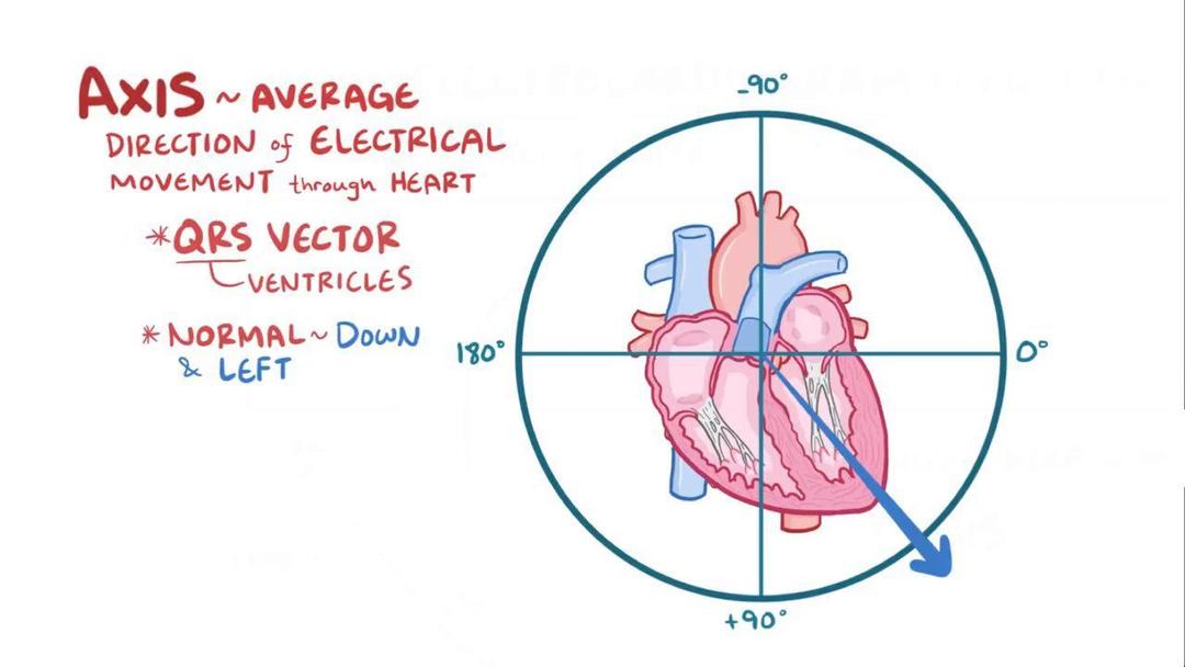 ECG axis: Video, Causes, & Meaning | Osmosis