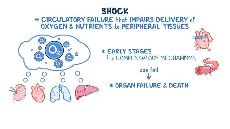 Approach to shock (pediatrics): Clinical sciences - Osmosis Video Library