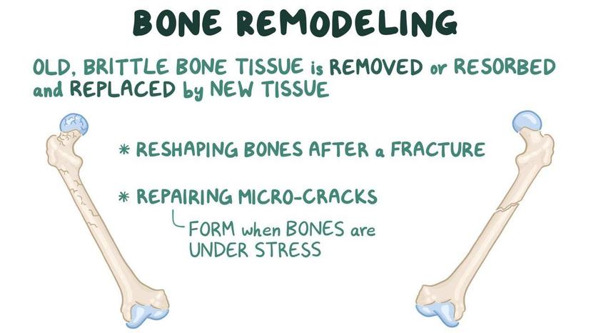 Bone remodeling and repair: Video, Causes, & Meaning | Osmosis