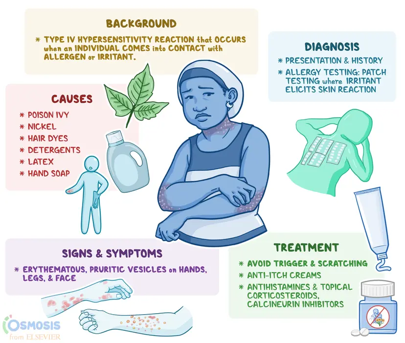 Contact Dermatitis: What Is It, Causes, Signs, Symptoms, and More | Osmosis