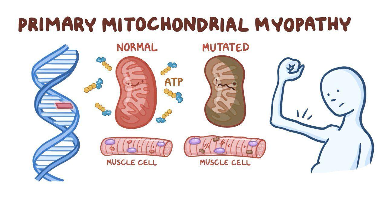 Miopatía mitocondrial: Vídeo, Anatomía & Definición | Osmosis