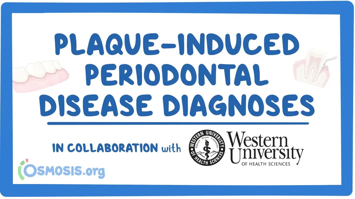 Video: Plaque-induced periodontal disease diagnoses | Osmosis