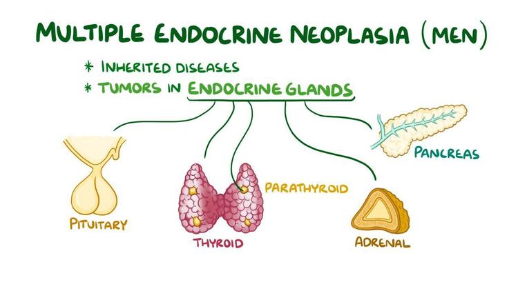 Multiple endocrine neoplasia: Video, Causes, & Meaning | Osmosis
