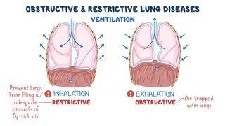 Video: Obstructive vs Restrictive Pulmonary Disease | Osmosis