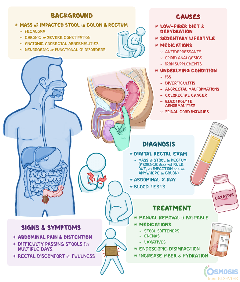 Fecal Impaction: What Is It, Causes, Treatment, and More | Osmosis
