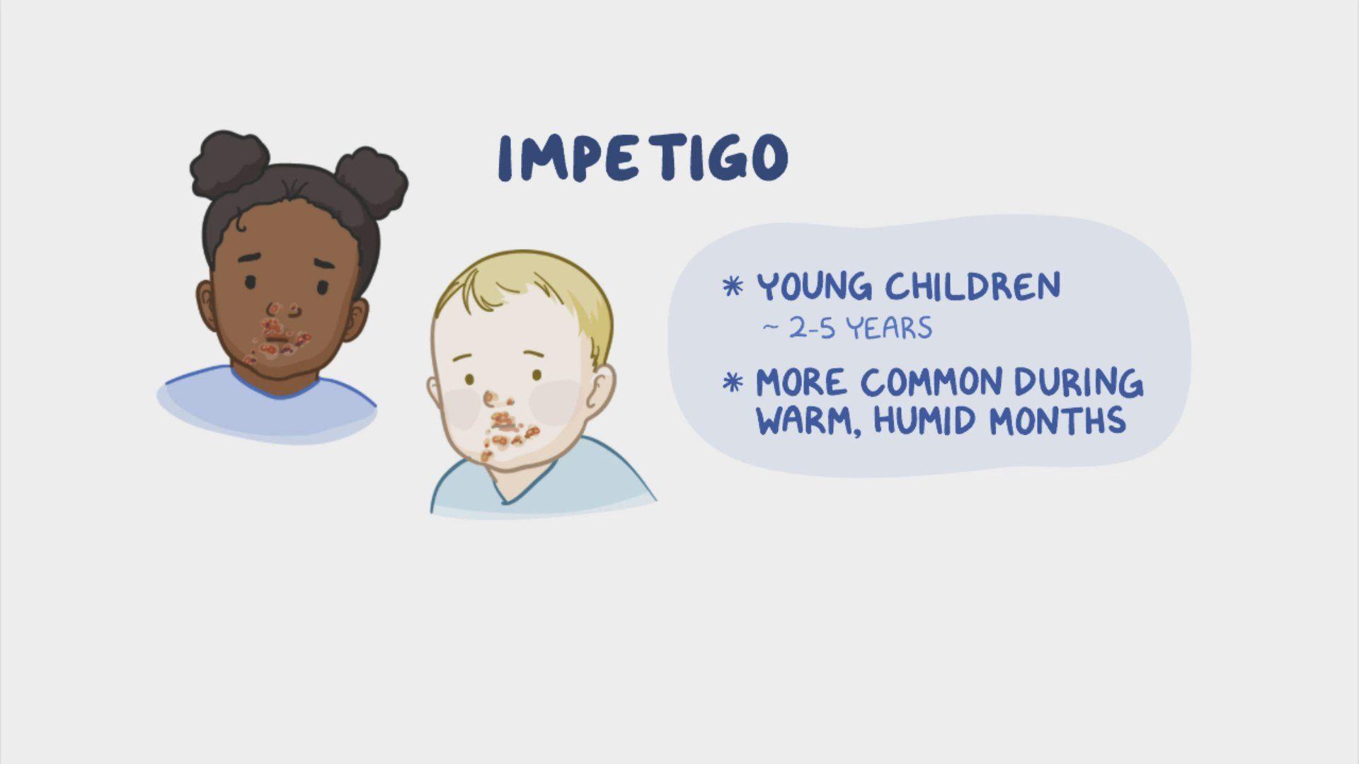 Impetigo: Nursing - Osmosis Video Library