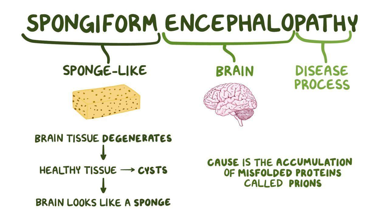 Prions (Spongiform encephalopathy): Video & Anatomy | Osmosis