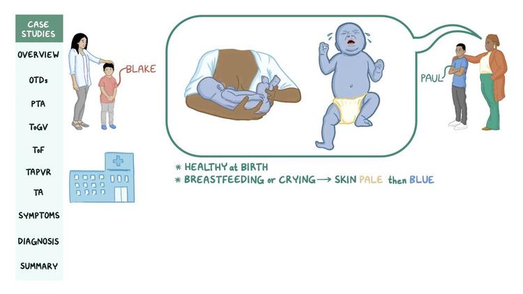 Cyanotic congenital heart defects: Pathology review | Osmosis