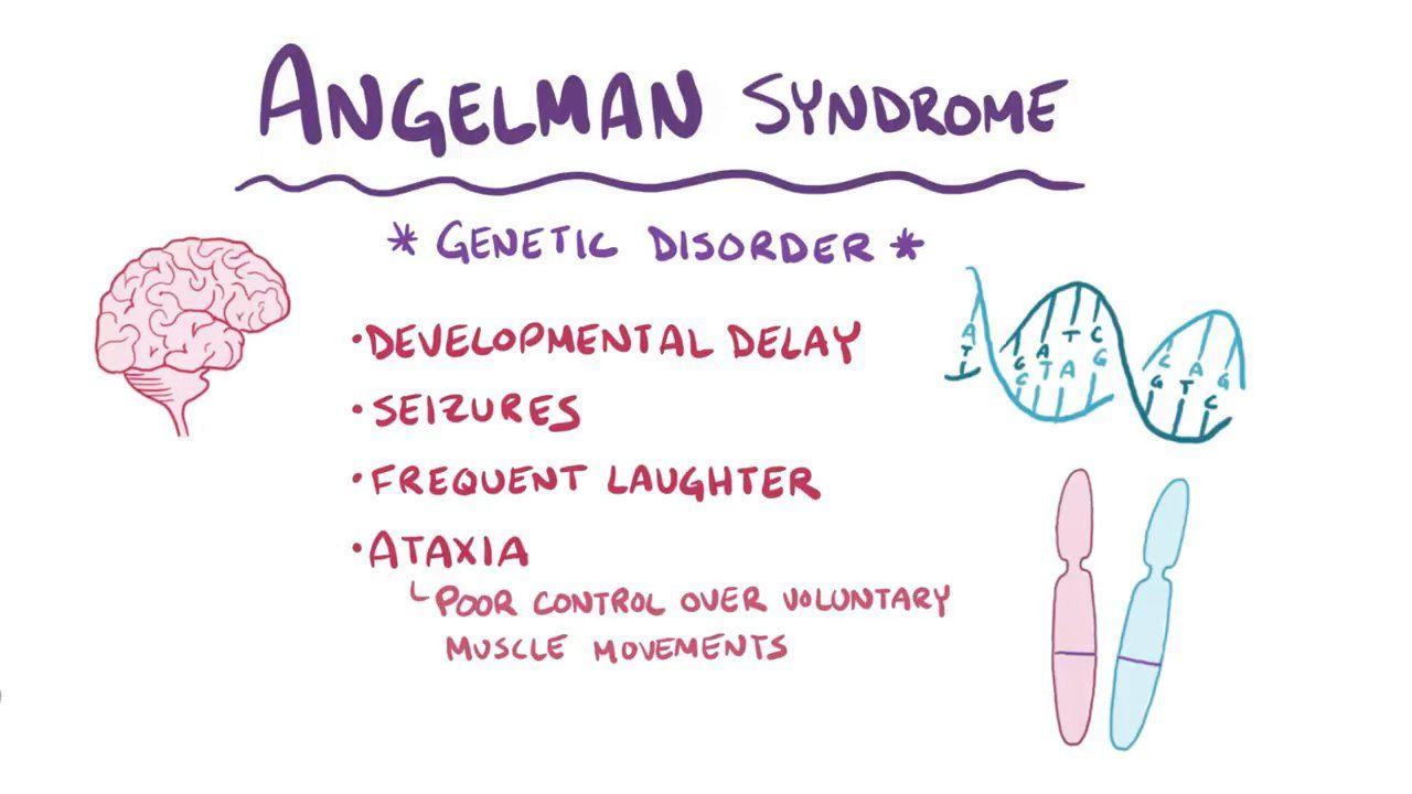 Síndrome de Angelman: Vídeo, Anatomía & Definición | Osmosis
