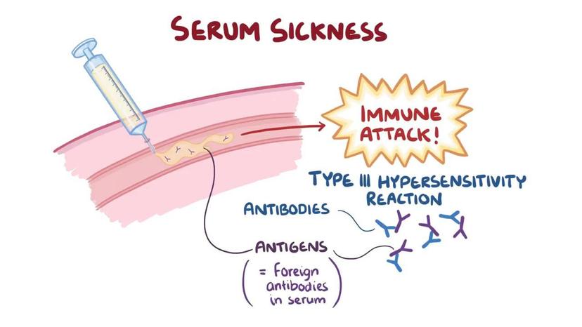 Serum sickness: Video, Anatomy, Definition & Function | Osmosis