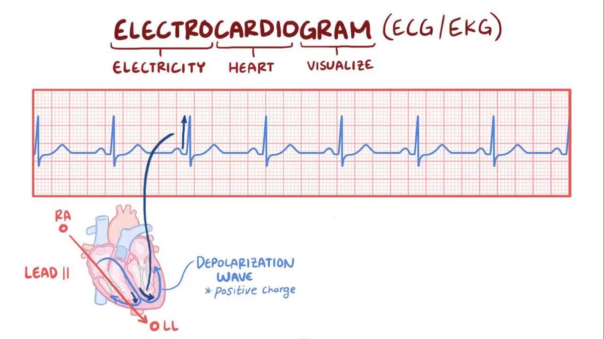 ECG basics: Video, Anatomy, Definition & Function | Osmosis