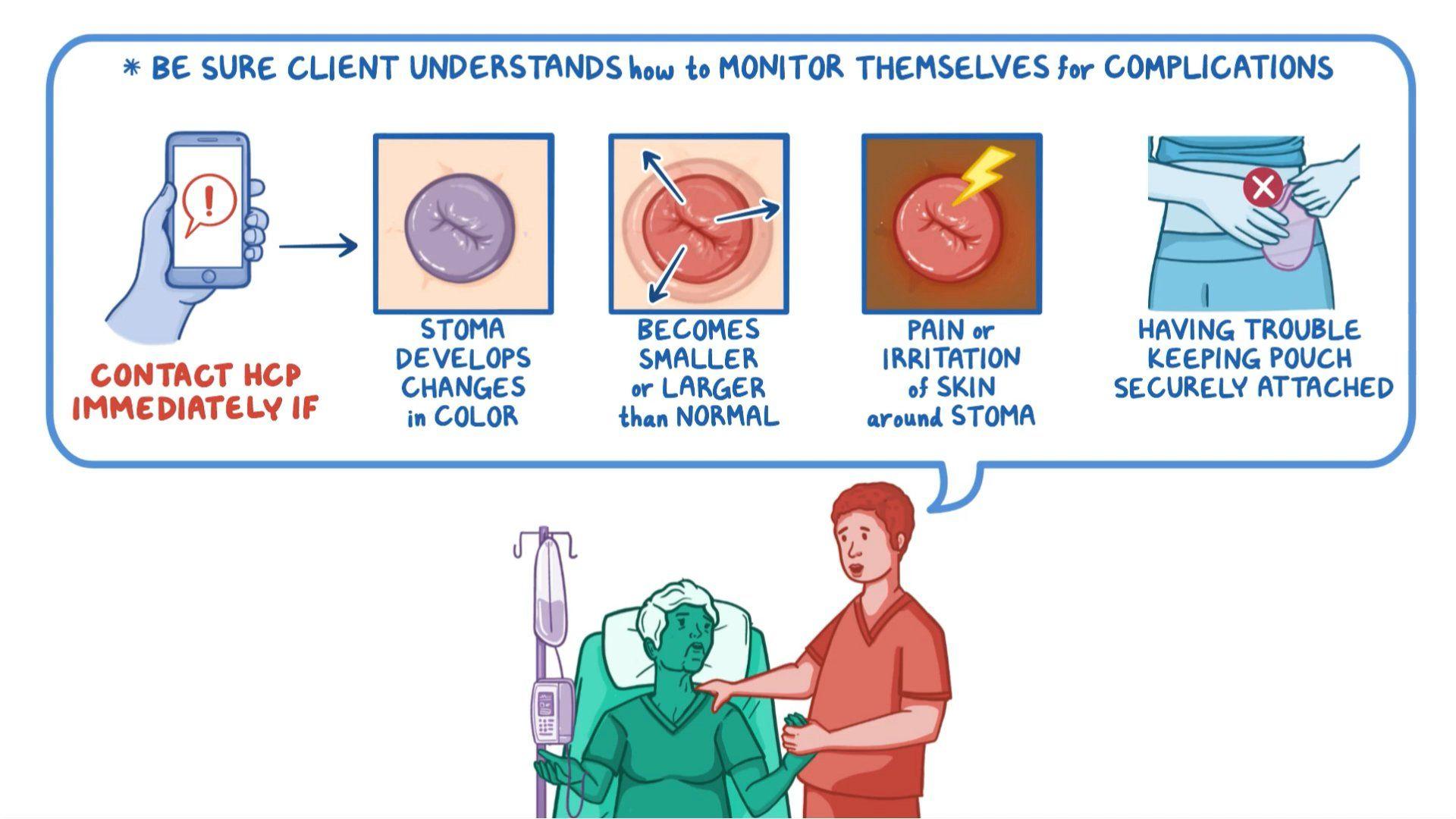 Colorectal cancer: Nursing - Osmosis Video Library