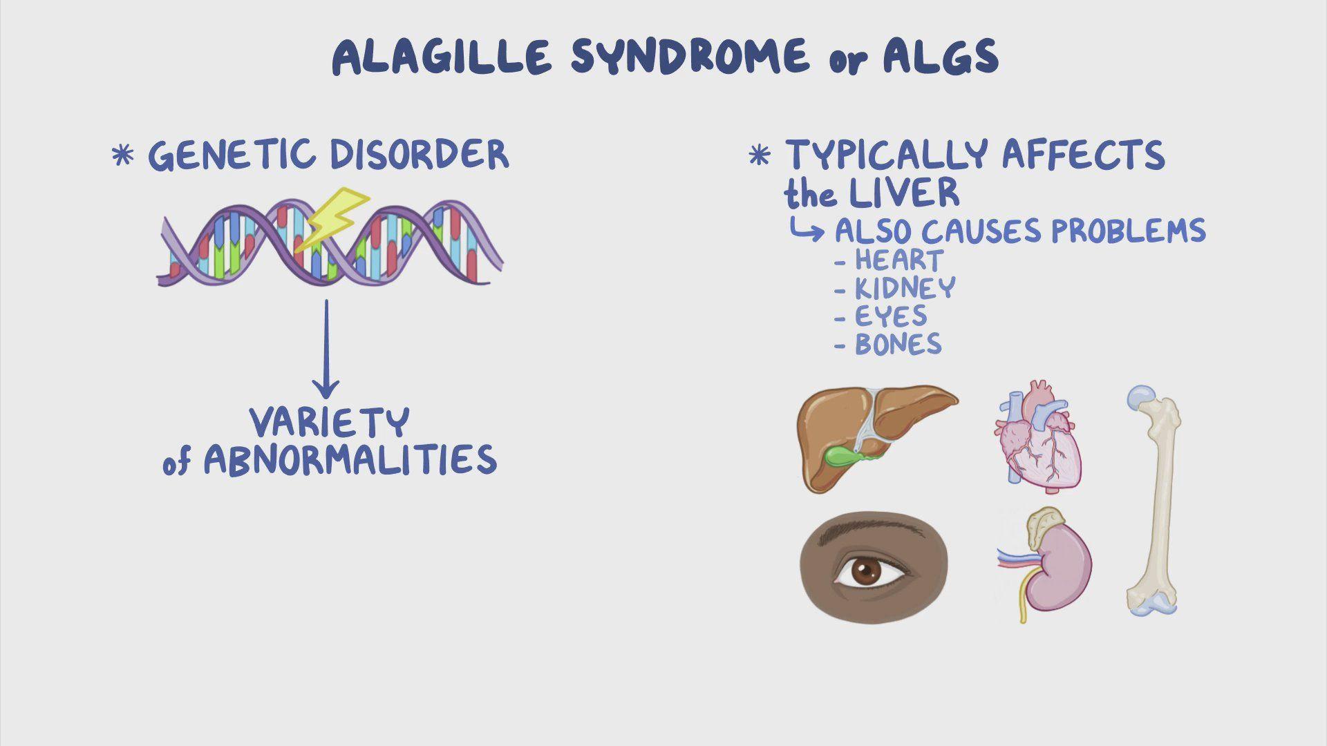 Alagille syndrome (NORD): Year of the Zebra: Video | Osmosis