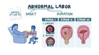 VEAL CHOP: Fetal Heart Rate Patterns Mnemonic | Osmosis