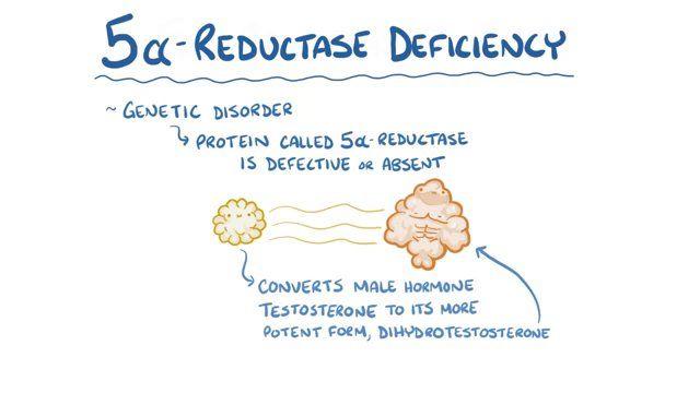 5-alpha-reductase deficiency: Video & Anatomy | Osmosis