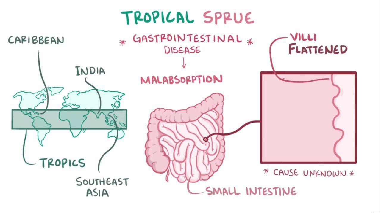 Tropical sprue: Video, Anatomy, Definition & Function | Osmosis
