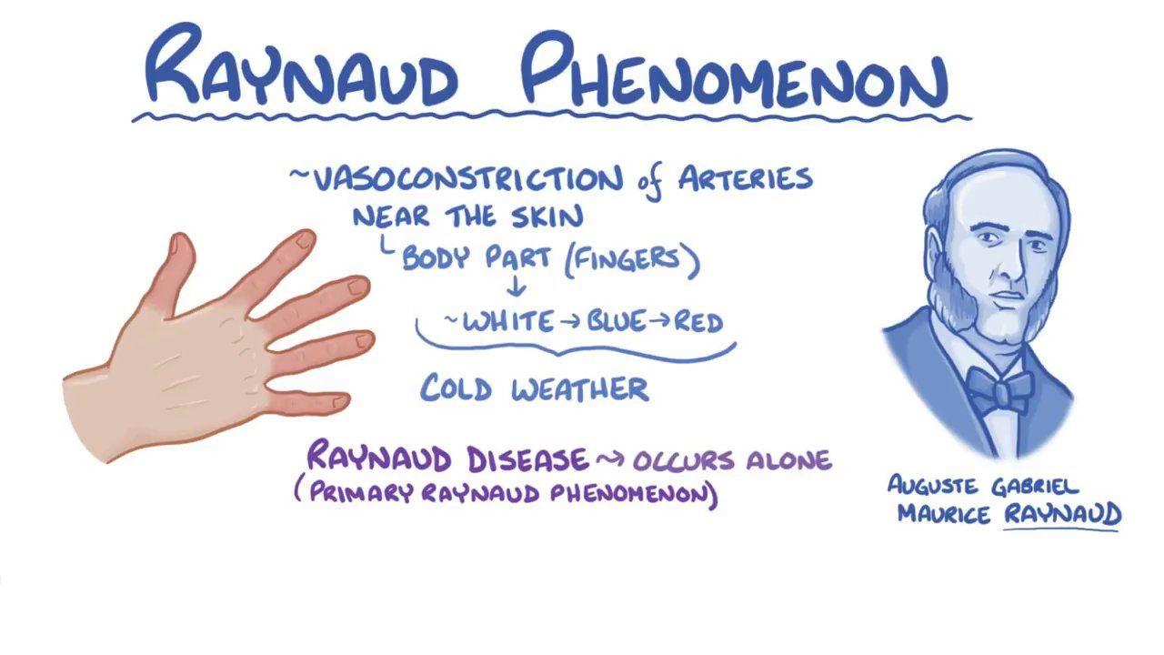 Raynaud phenomenon: Video, Anatomy & Definition | Osmosis