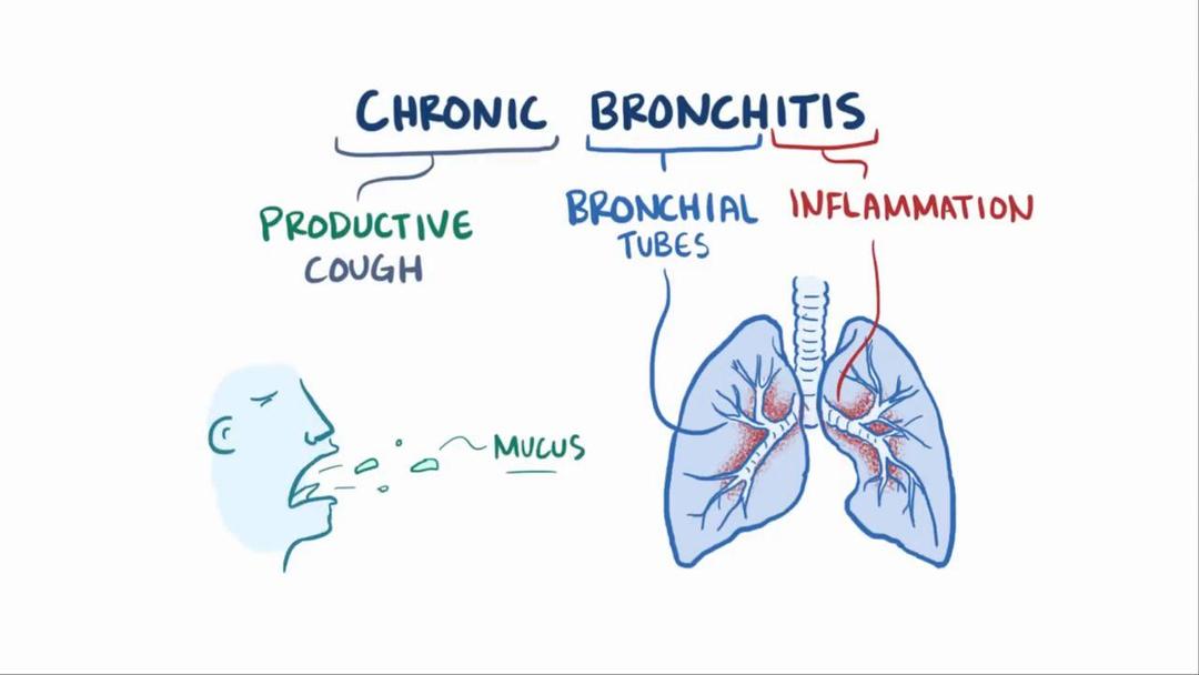 Chronic bronchitis: Video, Anatomy & Definition | Osmosis