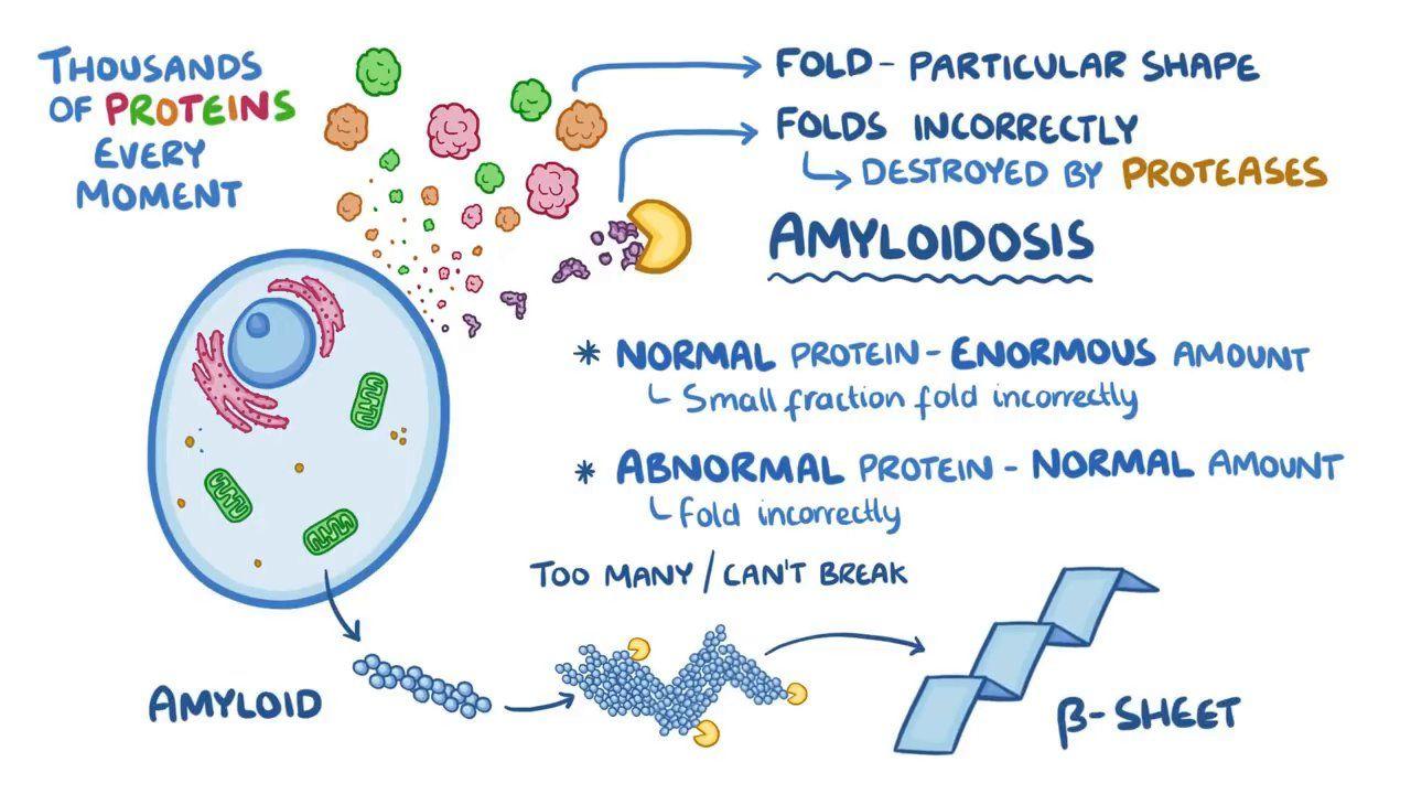 Amyloidosis: Video, Anatomy, Definition & Function | Osmosis