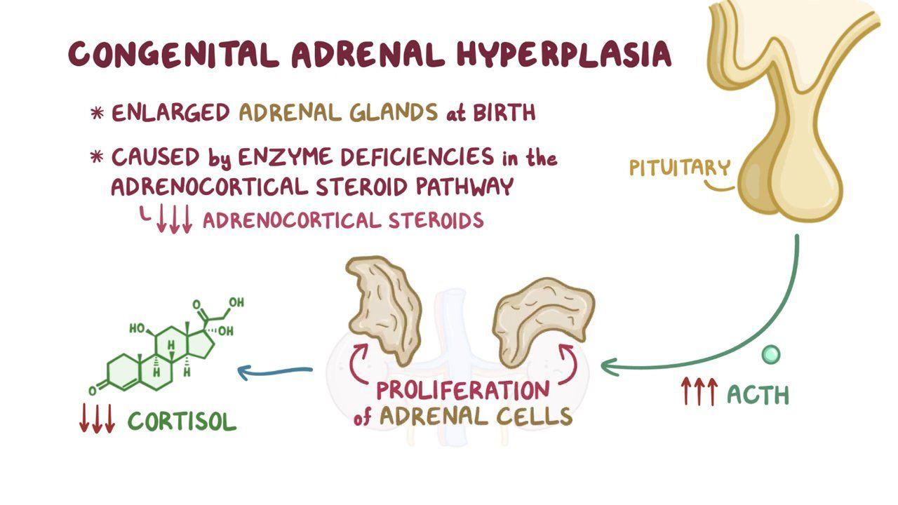 Congenital adrenal hyperplasia: Clinical: Video | Osmosis