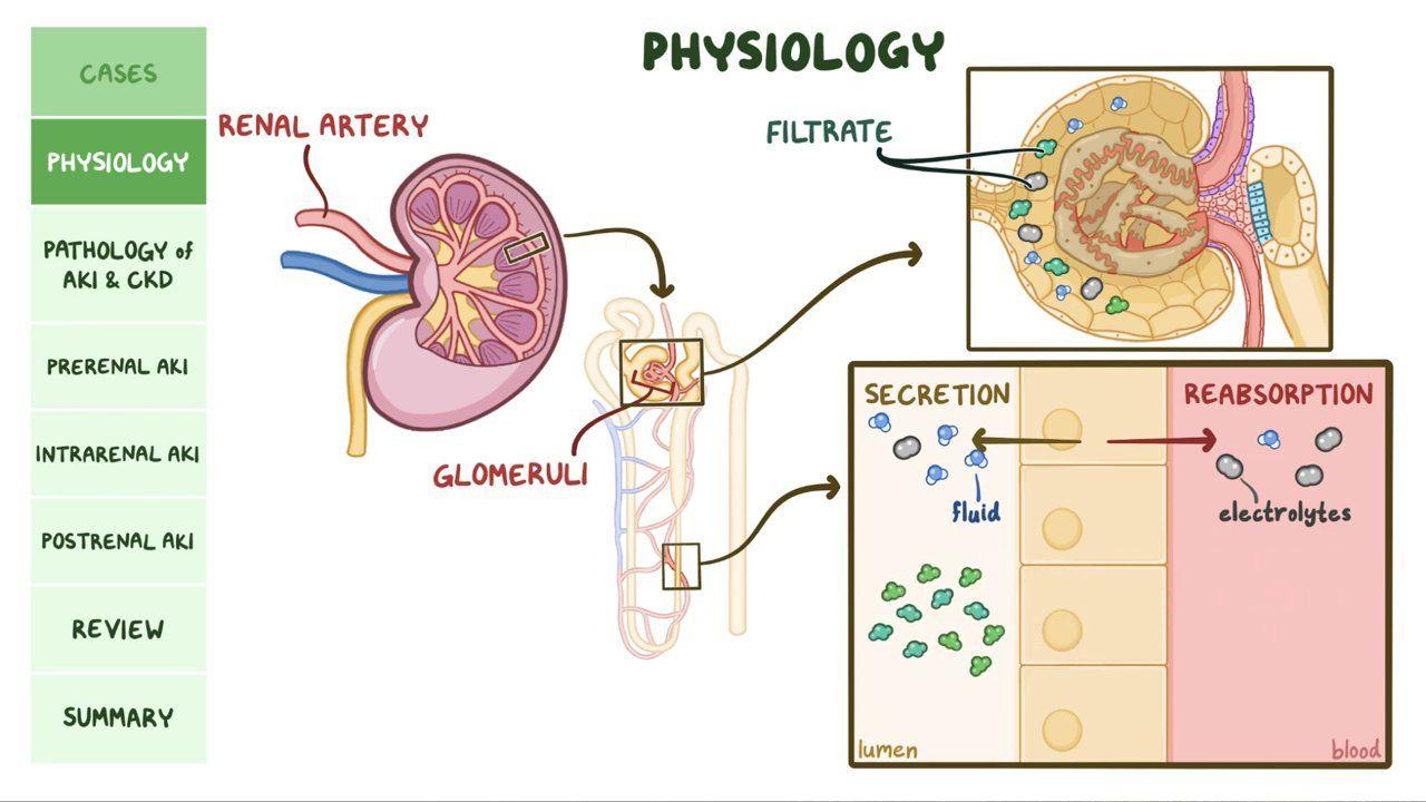 Renal failure: Pathology review: Video & Anatomy | Osmosis