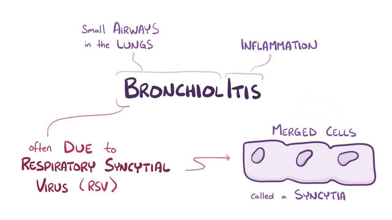Respiratory syncytial virus: Video & Anatomy | Osmosis
