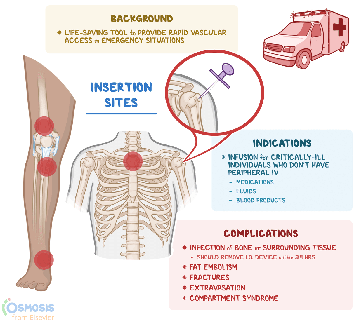 Intraosseous IO Device What Is It Osmosis Intraosseous IO Device What Is It Osmosis