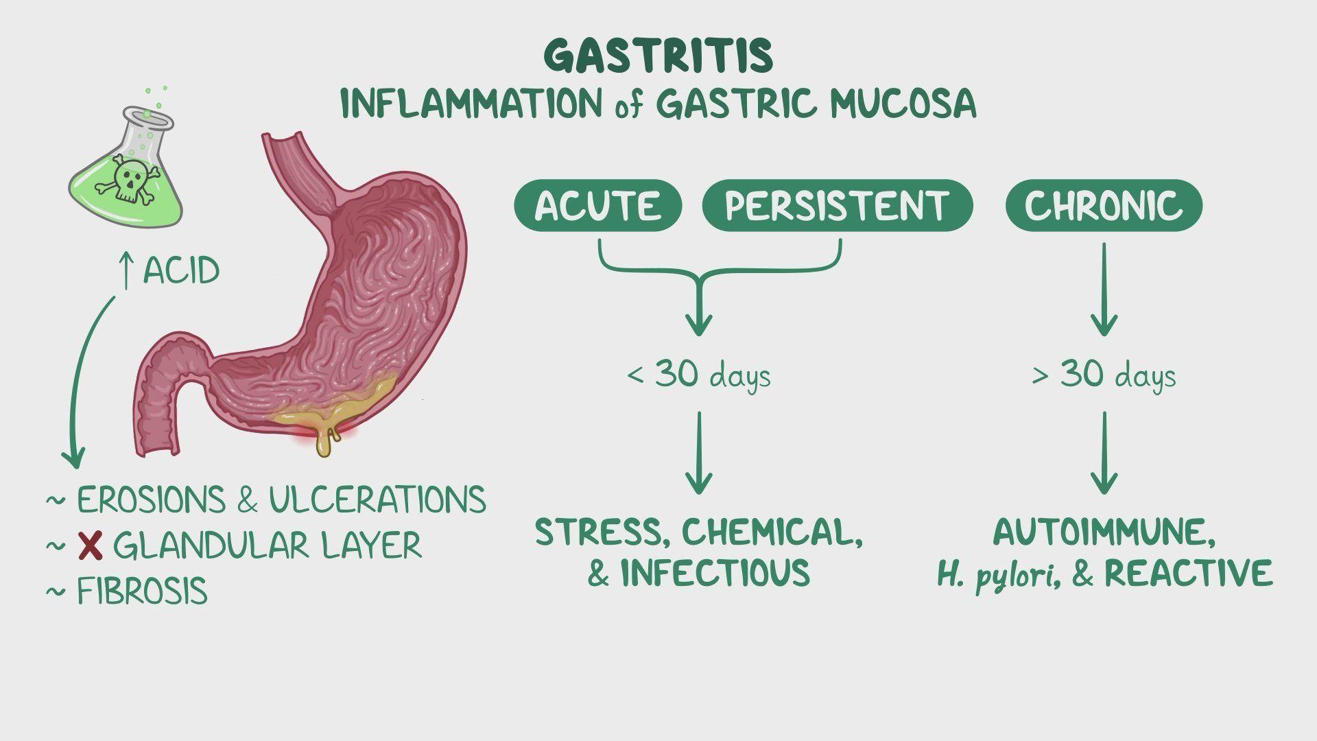 Gastritis Video Meaning Osmosis Gastritis Video Meaning Osmosis