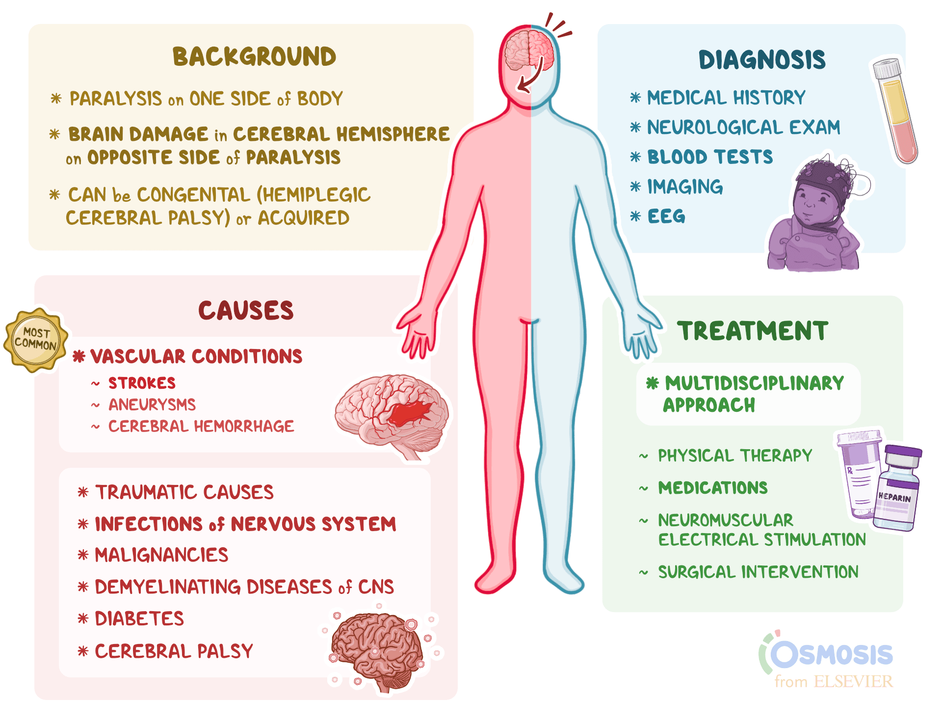 Hemiplegia What Is It Causes And More Osmosis Hemiplegia What Is It Causes And More Osmosis