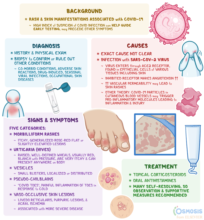 COVID Rash What Is It Signs Symptoms Treatment And More Osmosis COVID Rash What Is It Signs Symptoms Treatment And More Osmosis