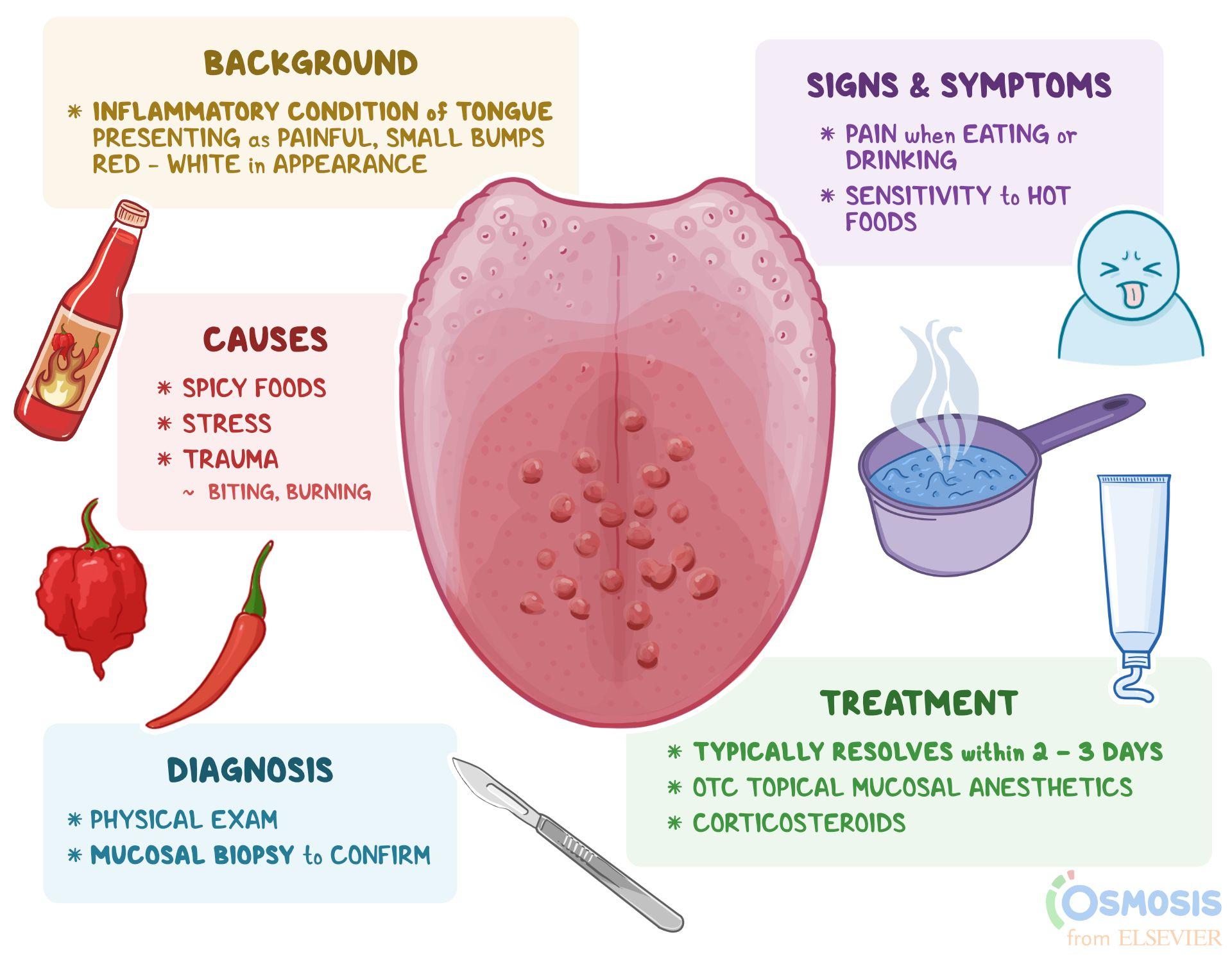 Transient Lingual Papillitis Lie Bumps On Tongue Osmosis Transient Lingual Papillitis Lie Bumps On Tongue Osmosis