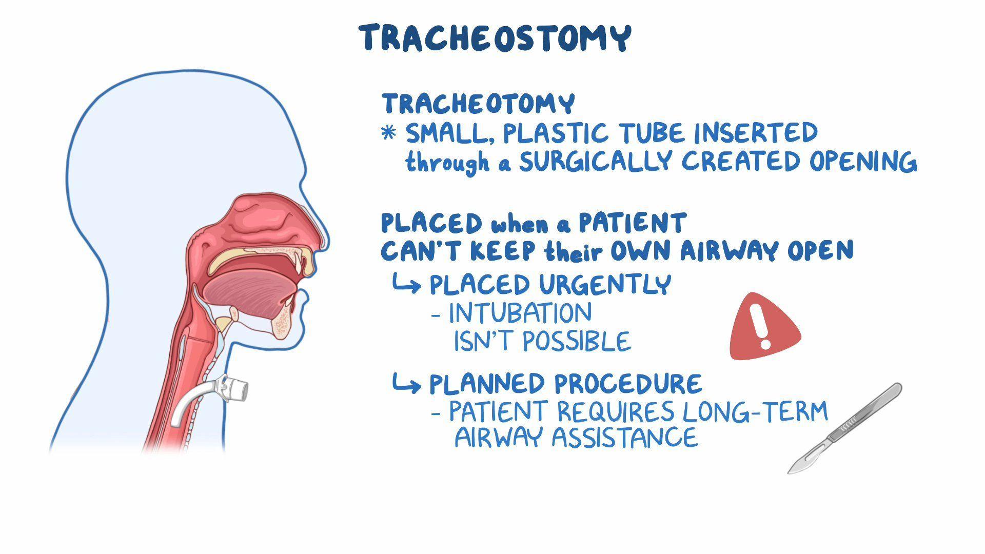 Tracheostomy Video Causes Meaning Osmosis Tracheostomy Video Causes Meaning Osmosis