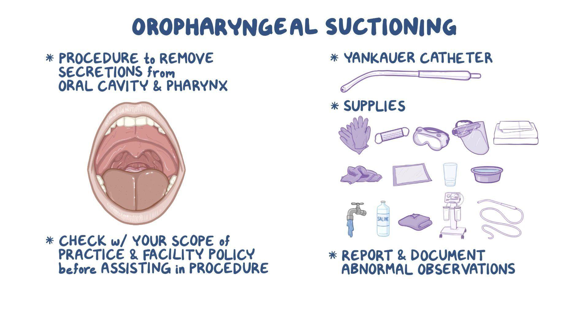 Nasopharyngeal Suctioning New NMC TOC 2022 Nasopharyngeal Suction Nasopharyngeal Suctioning New NMC TOC 2022 Nasopharyngeal Suction